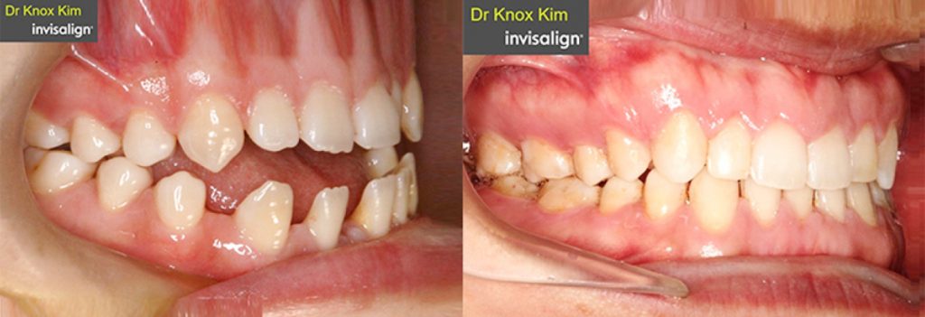 We have the latest in cavity treatment and orthodontics! - Dental ...