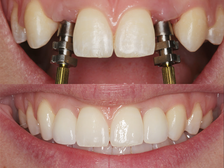 シドニーで日本語受診できる歯医者まとめ | JAMS.TV オーストラリア生活情報ウェブサイト